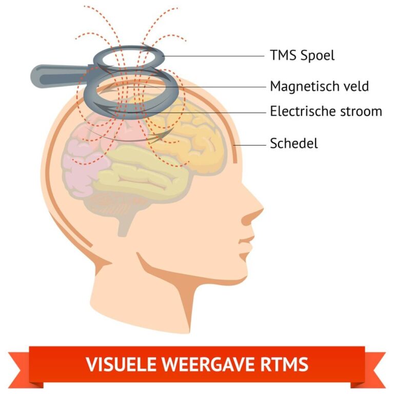 rTMS behandeling en de magnetische spoel | Psyned